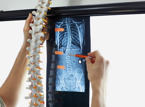 Why Accurate Pain Diagnosis is Important - Dr. Robert Ycaza - Bradenton ...