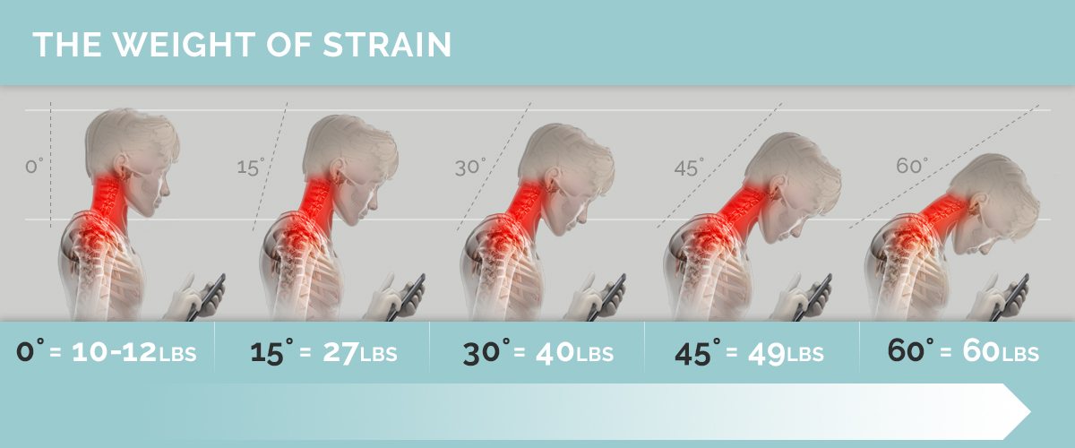WHY IS THE BURDEN OF NECK PAIN SEEN AS DEVASTATING? - Dr. Robert Ycaza ...